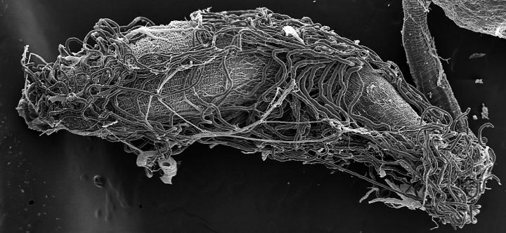 Scanning Electron Microscopy I [IMAGE] | EurekAlert! Science News Releases