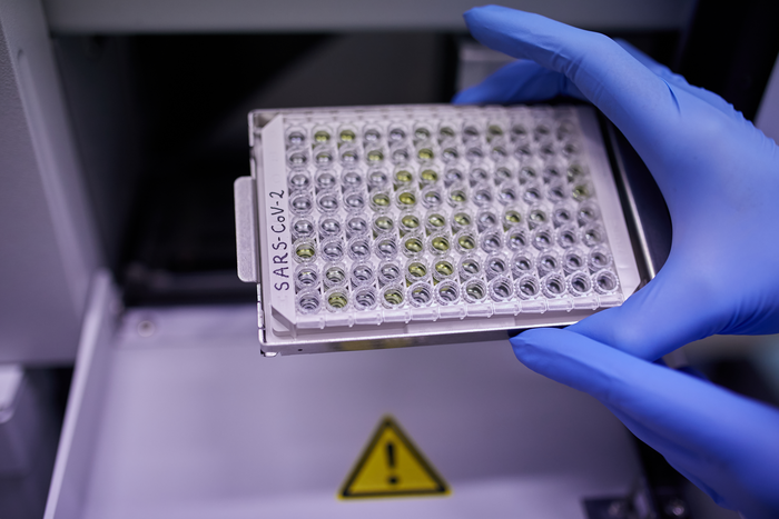 Assay to detect the biochemica [IMAGE] | EurekAlert! Science News Releases