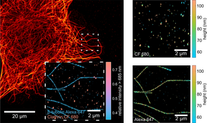 Microscopy technique enables 3D super-resolut | EurekAlert!