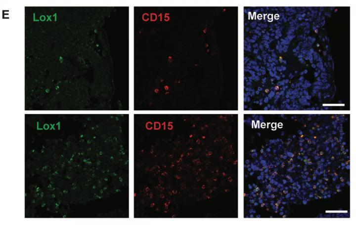 Good Cell, Bad Cell: What Make [IMAGE] | EurekAlert! Science News Releases