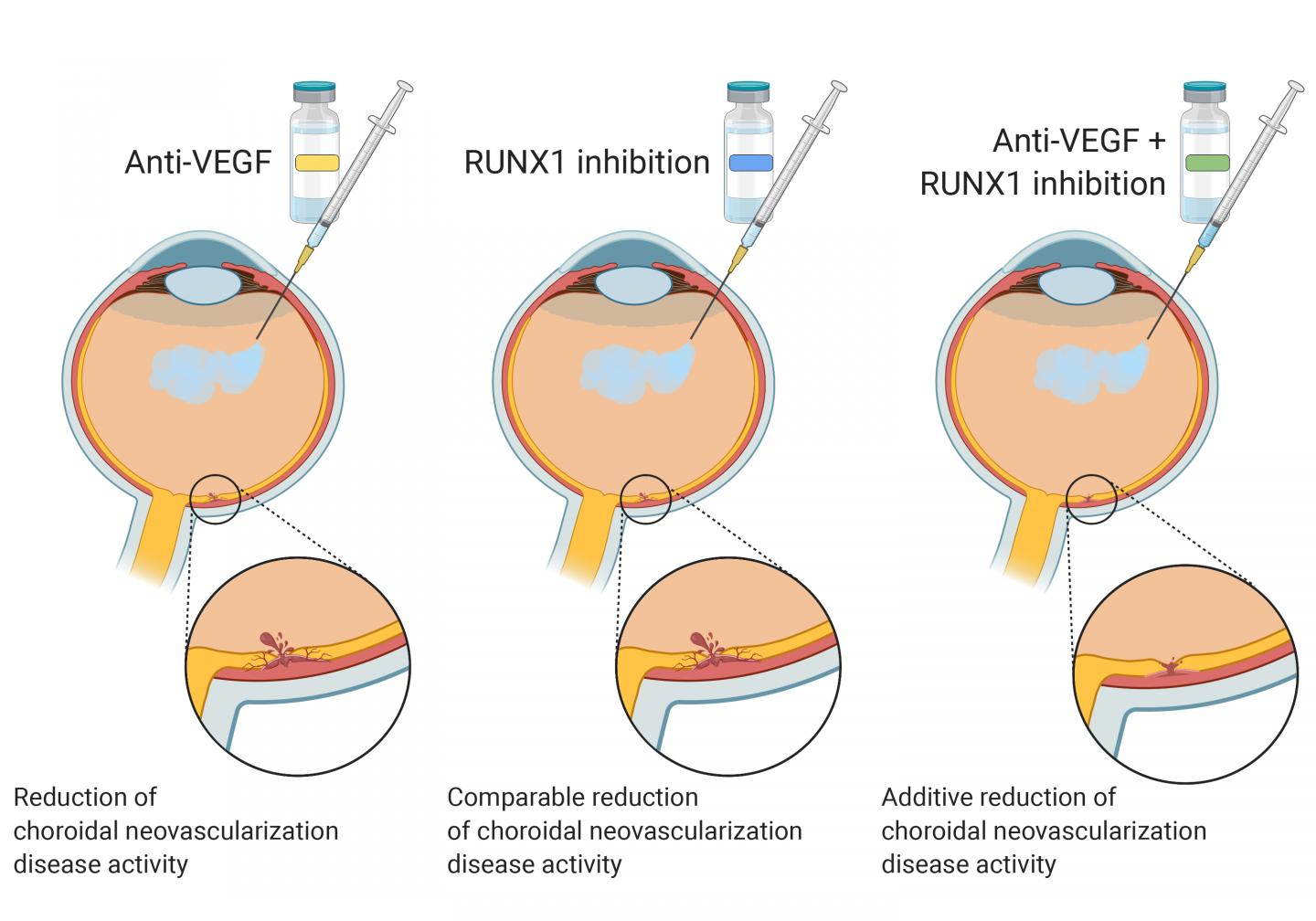 New Therapeutic Approach May Help Treat Age r EurekAlert 