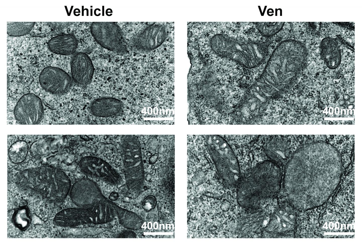 Making Leukemia Tumor Cells Sensitive Again, | EurekAlert!