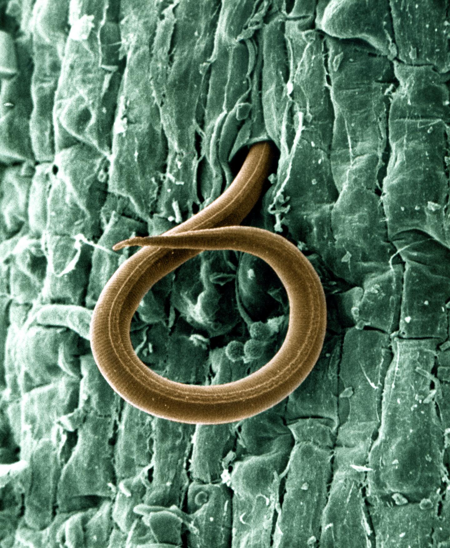 Root-Knot Nematode [IMAGE] | EurekAlert! Science News Releases