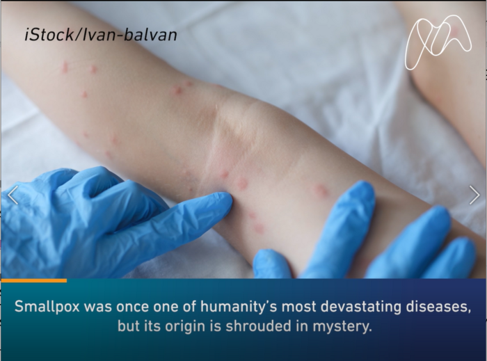 Smallpox has plagued humans since ancient Egy | EurekAlert!