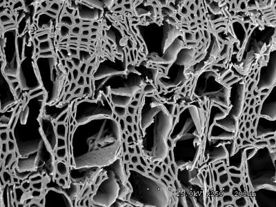 Micrograph of B. Botryosum on [IMAGE] | EurekAlert! Science News Releases