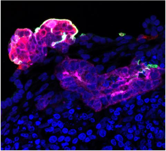 Human Kidney Organoid. [IMAGE] | EurekAlert! Science News Releases