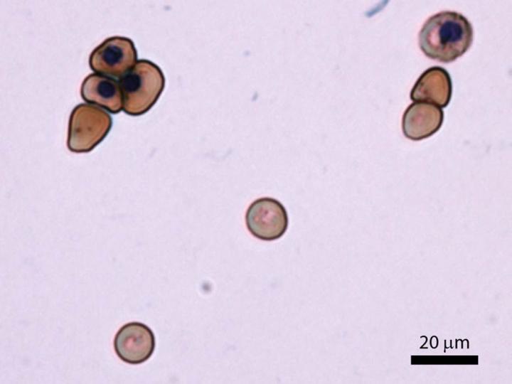 Lab-Grown Human Blood Cells [IMAGE] | EurekAlert! Science News Releases