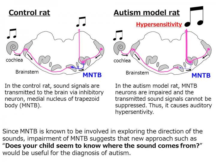 Auditory Pathway in the Autism [IMAGE] | EurekAlert! Science News Releases