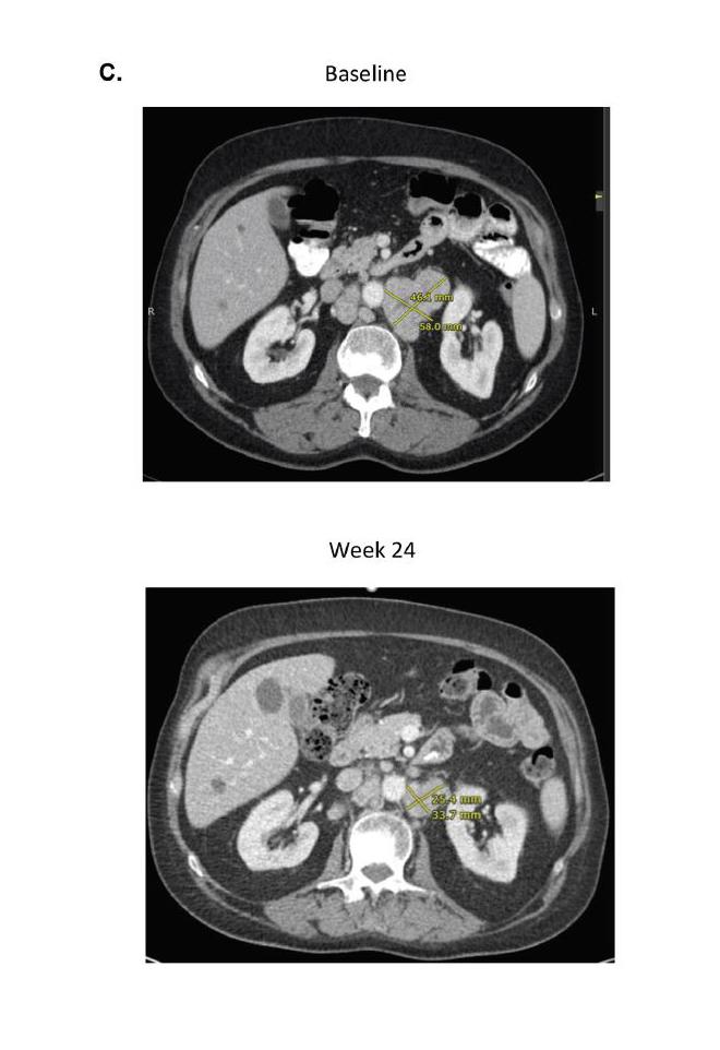 CT Scan [IMAGE] | EurekAlert! Science News Releases