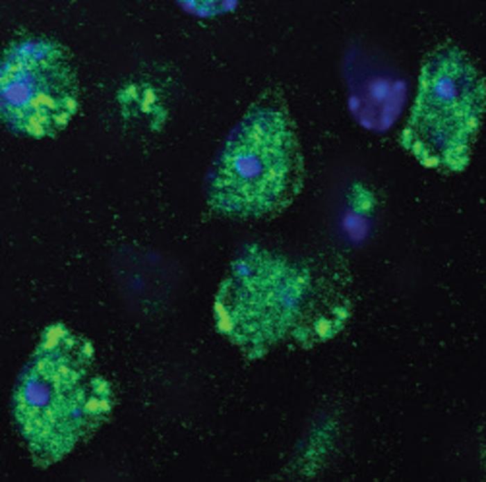 FUS aggregates [IMAGE] | EurekAlert! Science News Releases