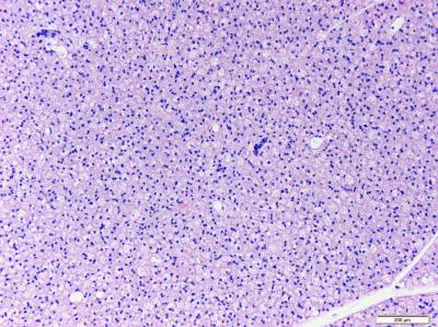 Knowing how brown fat cells develop may help | EurekAlert!