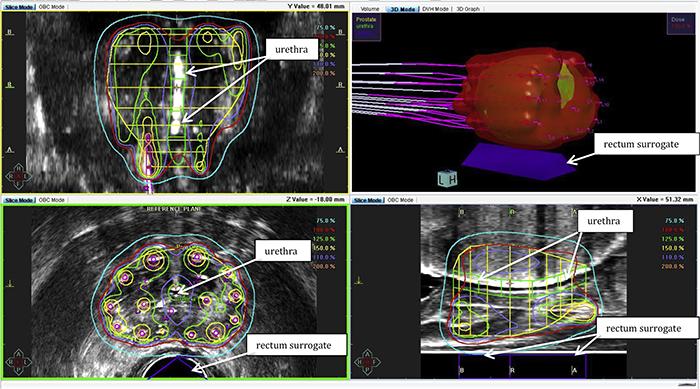 Study Image [IMAGE] | EurekAlert! Science News Releases