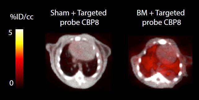 A New Imaging Tool Can Detect and Monitor Lun | EurekAlert!