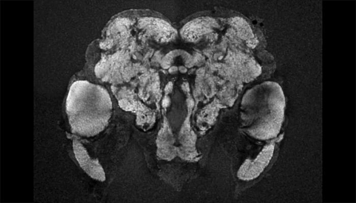 Mosquito Brain Map [IMAGE] | EurekAlert! Science News Releases