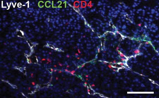 How Invasive Tumors Open Thems [IMAGE] | EurekAlert! Science News Releases