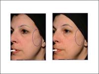 Science finds new fix for UV-damaged skin in | EurekAlert!