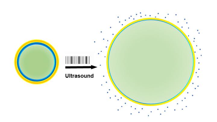 Ultrasound [IMAGE] | EurekAlert! Science News Releases