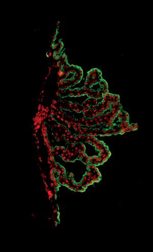 Choroid Plexus [IMAGE] | EurekAlert! Science News Releases