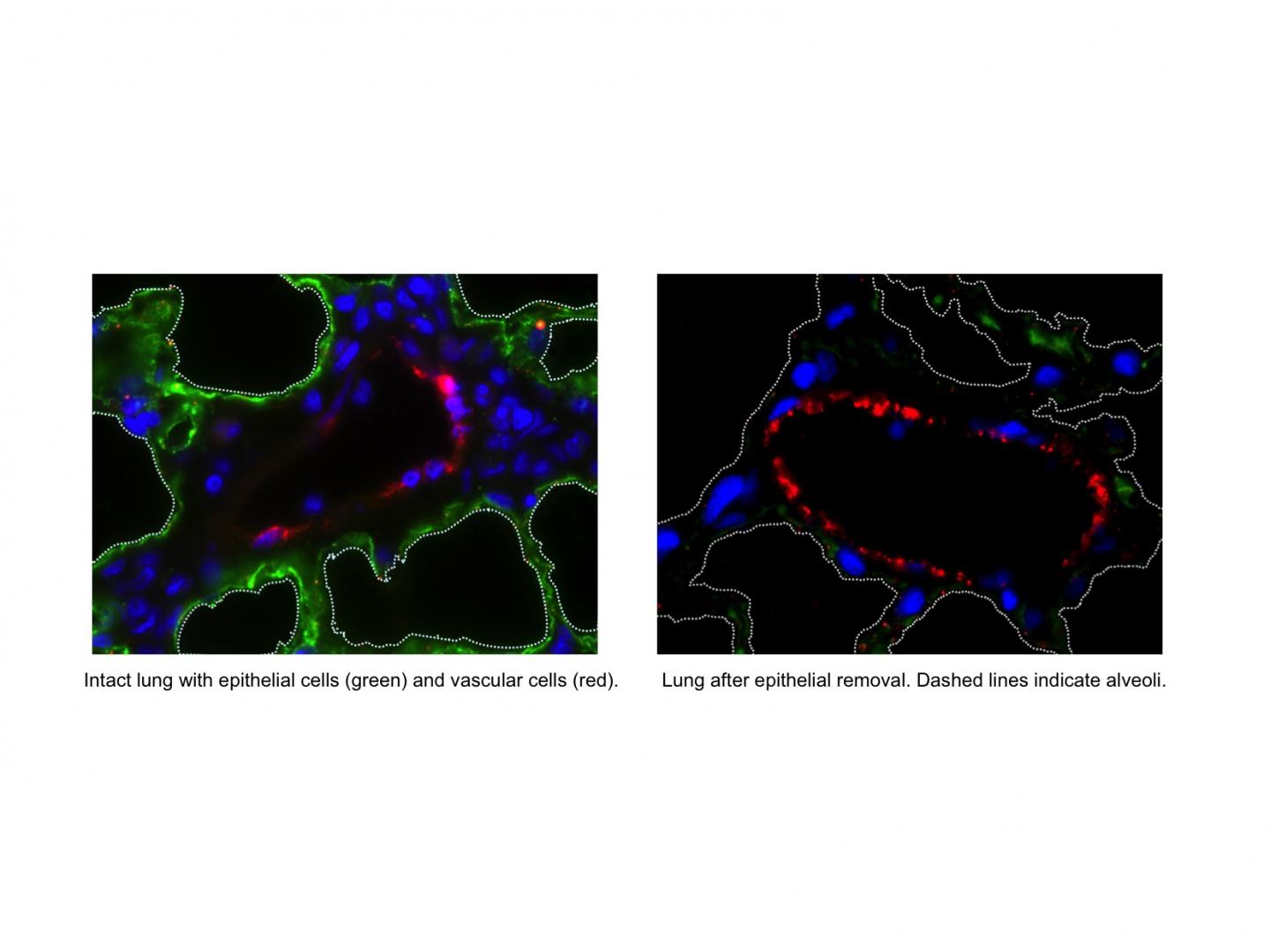 Functional Vascularized Graft [IMAGE] | EurekAlert! Science News Releases