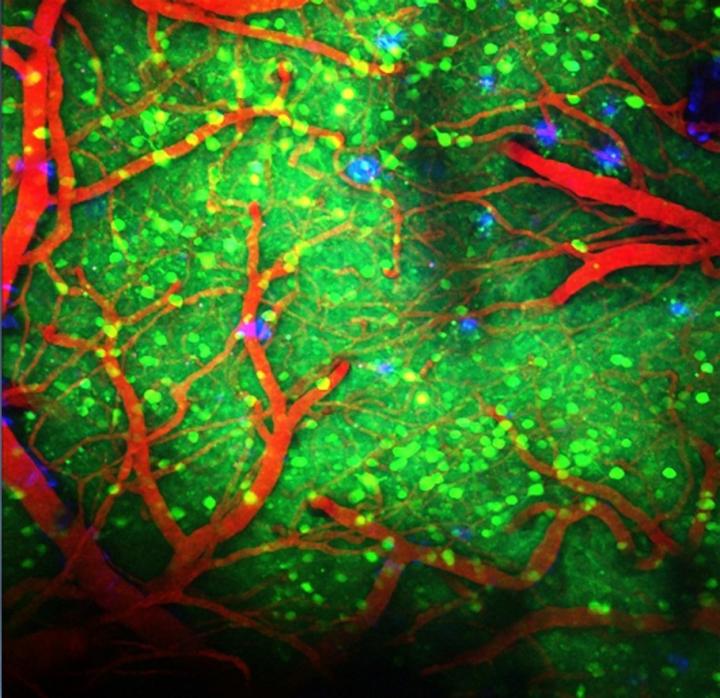 Neural imaging [IMAGE] | EurekAlert! Science News Releases