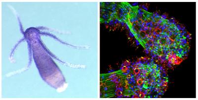Stinging Cells [IMAGE] | EurekAlert! Science News Releases