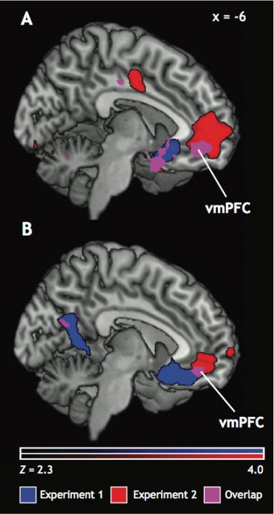 Buying and the Ventromedial Pr [IMAGE] | EurekAlert! Science News Releases