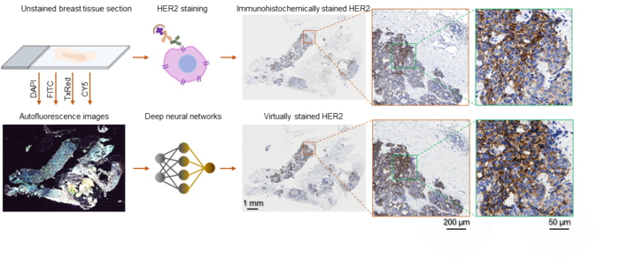 Virtual HER2 staining of unlab [IMAGE] | EurekAlert! Science News Releases