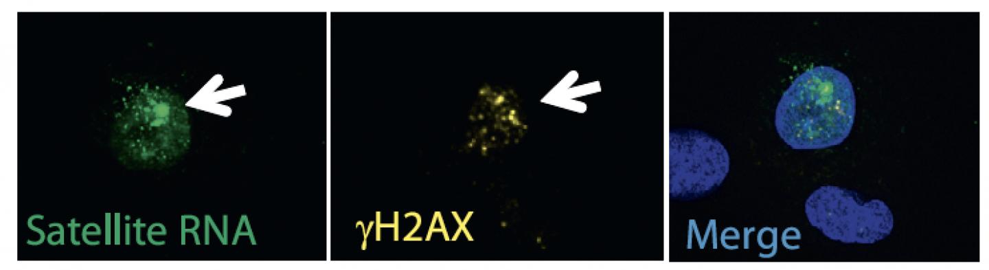 What the satellites in your body do | EurekAlert!