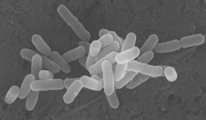 E. coli from Cattle [IMAGE] | EurekAlert! Science News Releases