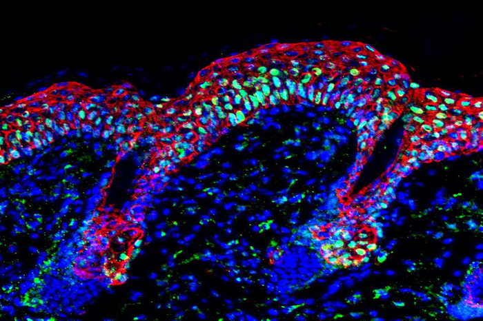 Inflamed mouse stem cells [IMAGE] | EurekAlert! Science News Releases