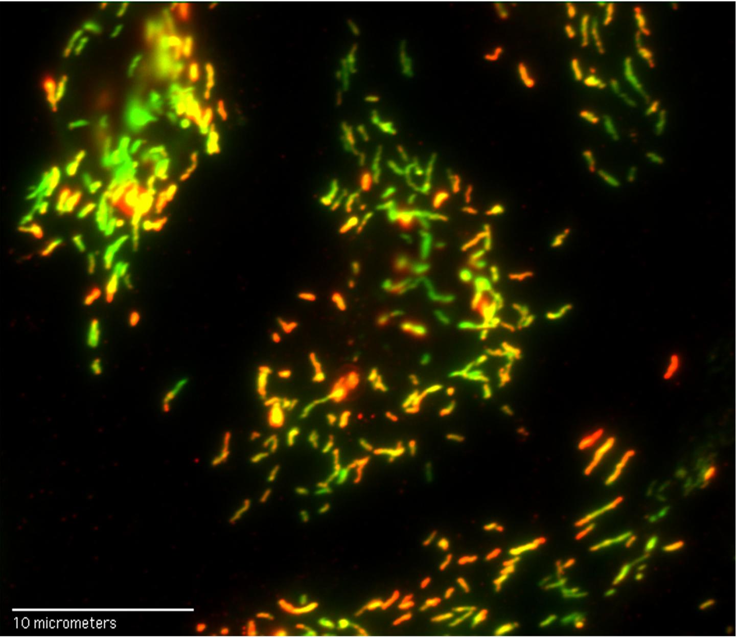 Antibodies [IMAGE] | EurekAlert! Science News Releases
