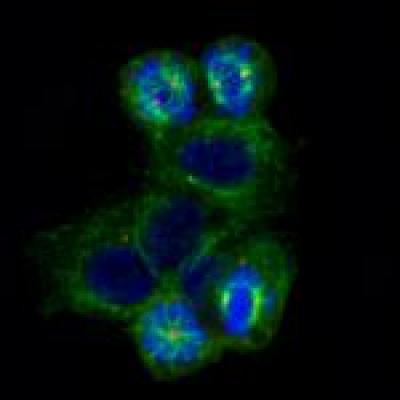 Abnormal Mitotic Spindles [IMAGE] | EurekAlert! Science News Releases