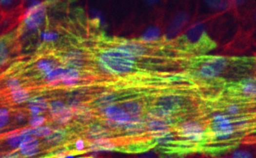 iPS-differentiated Cardiomyocy [IMAGE] | EurekAlert! Science News Releases