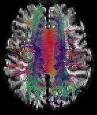 Lek-Heng Lim receives Wilkinson Prize in Nume | EurekAlert!