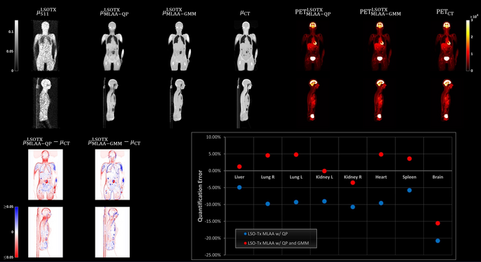Novel ultra-low dose PET technique significan | EurekAlert!