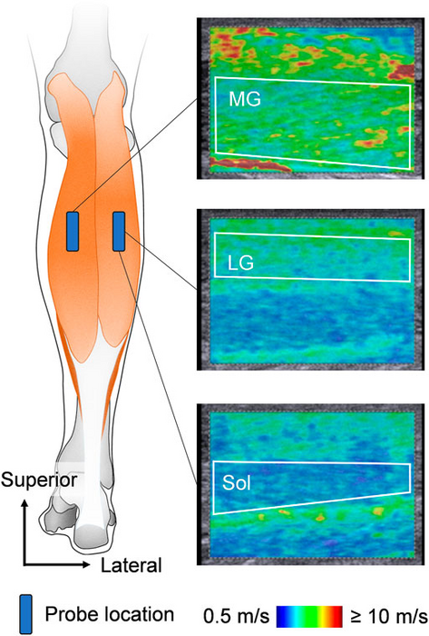 Schematic of ultrasound probe [IMAGE] | EurekAlert! Science News Releases