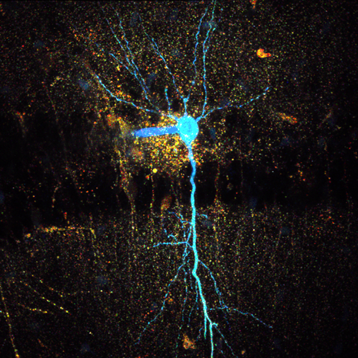 CA1 pyramidal neuron [IMAGE] | EurekAlert! Science News Releases