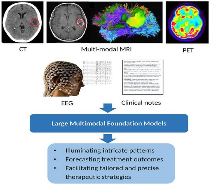 Artificial general intelligence for radiation | EurekAlert!