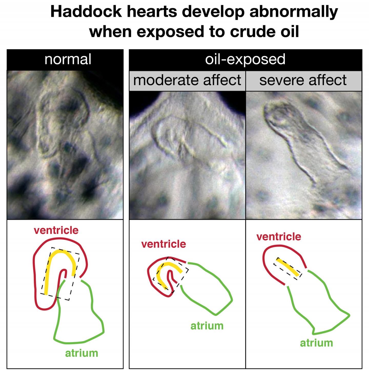 Haddock Heart Deformities Foll [IMAGE] | EurekAlert! Science News Releases