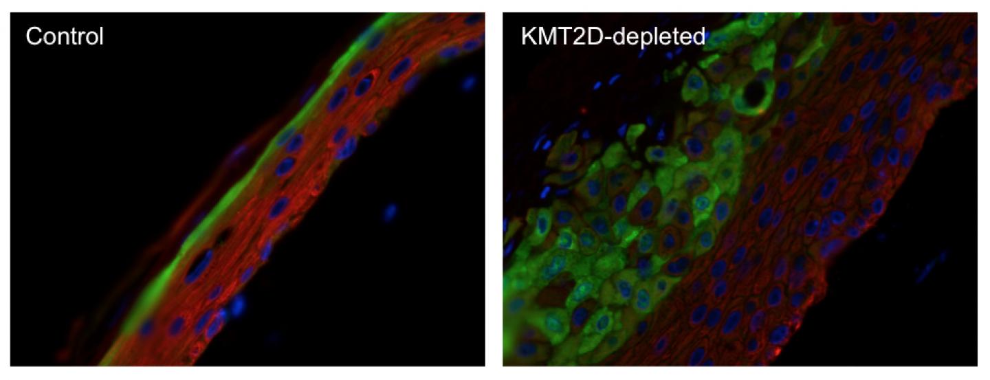 With and Without KMT2D [IMAGE] | EurekAlert! Science News Releases
