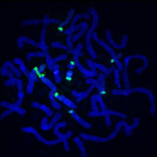 Ribosomal DNA [IMAGE] | EurekAlert! Science News Releases