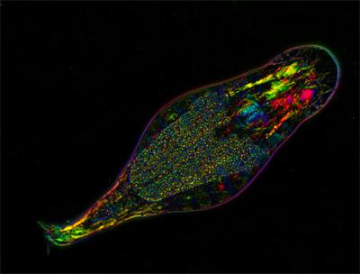 Bdelloid Rotifer, Adineta v [IMAGE] | EurekAlert! Science News Releases