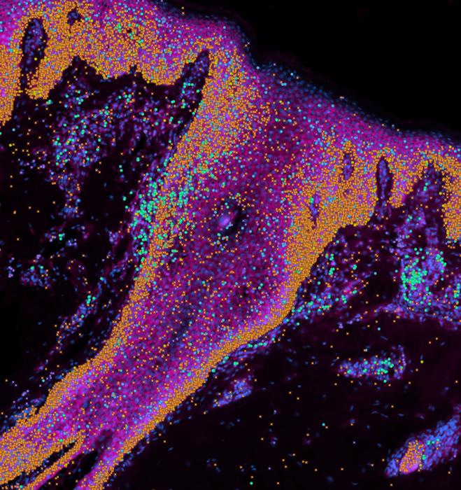Xenium of human skin, zoomed i [IMAGE] | EurekAlert! Science News Releases