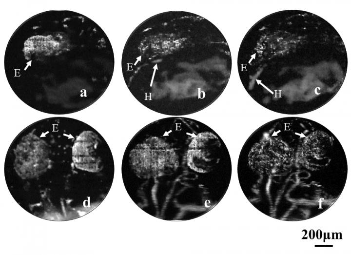 Researchers watch blood vessels develop in wh | EurekAlert!