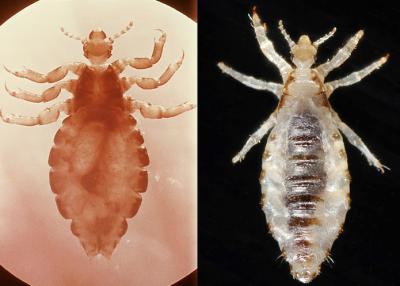 Head Louse Versus Body Louse [IMAGE] | EurekAlert! Science News Releases
