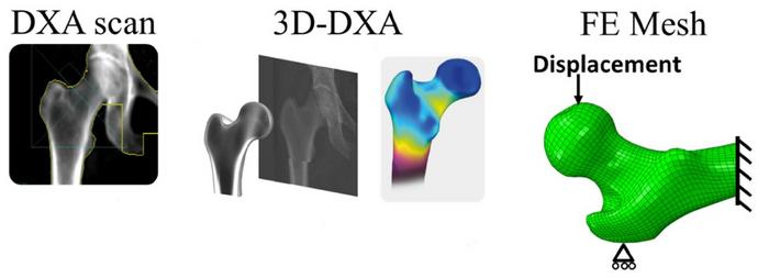 The new methodology (3D-DXA) [IMAGE] | EurekAlert! Science News Releases