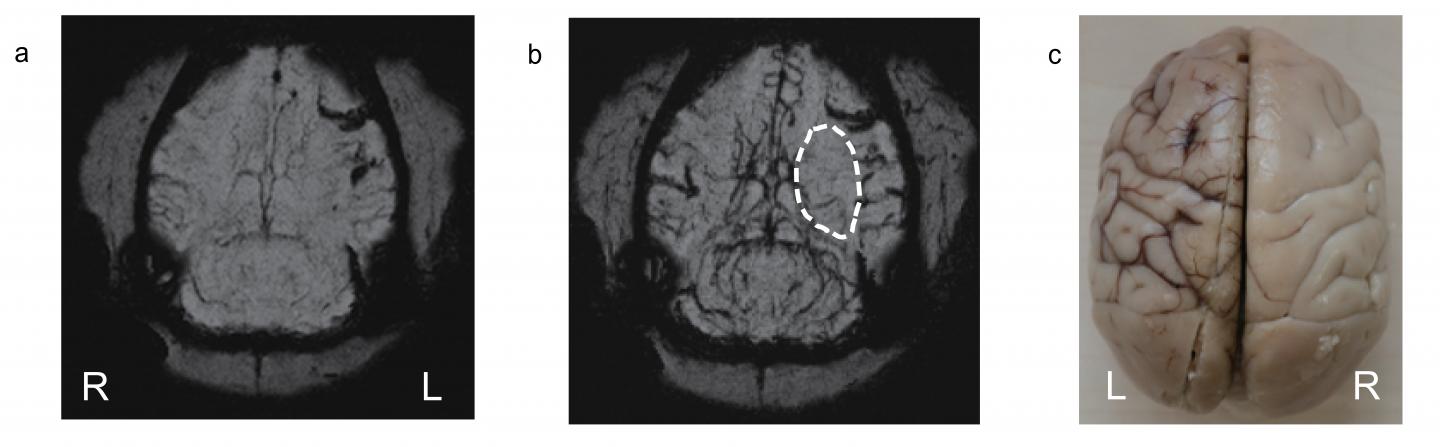 Whole Brain Imaging of a Monke [IMAGE] | EurekAlert! Science News Releases