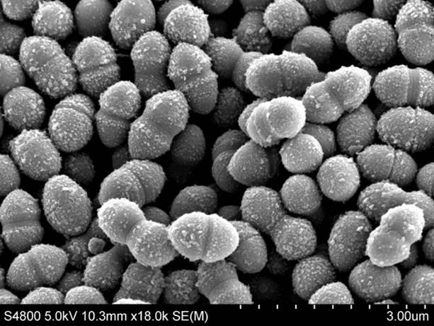 Scientists find new variant of streptococcal | EurekAlert!