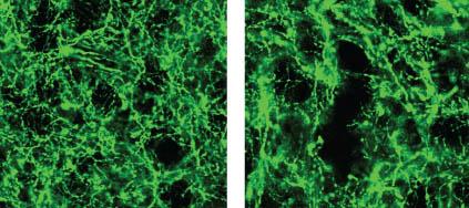 Dopamine Neurons [IMAGE] | EurekAlert! Science News Releases