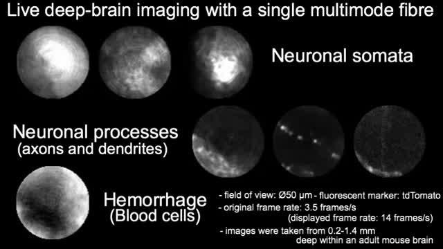 Insight into the brain's hidden depths: Jena | EurekAlert!